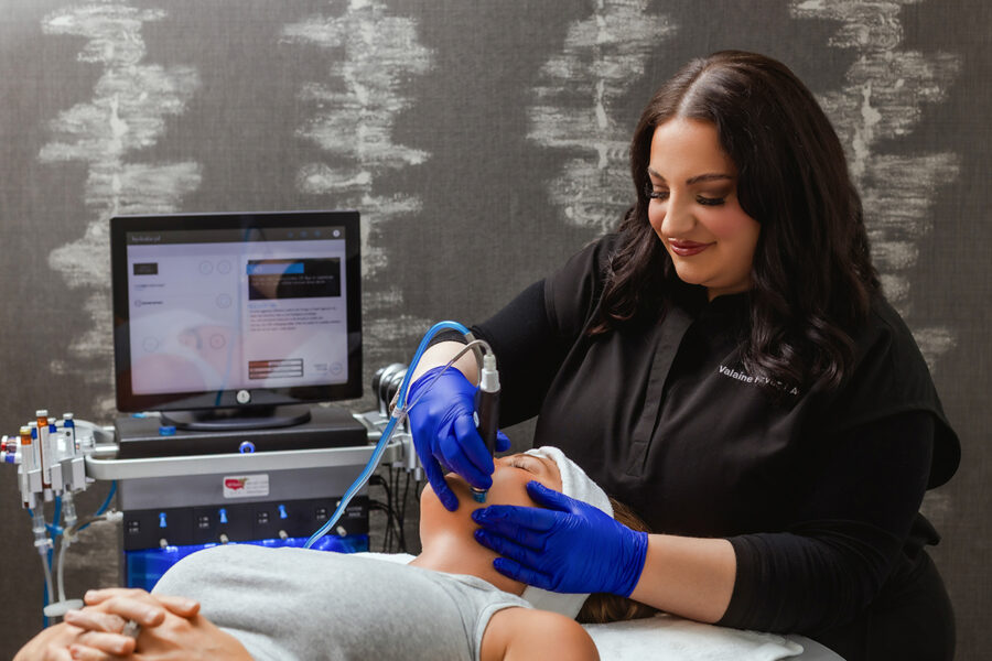 Acne Scar Treatment in Centerville & Mason, OH | Spa Medicca