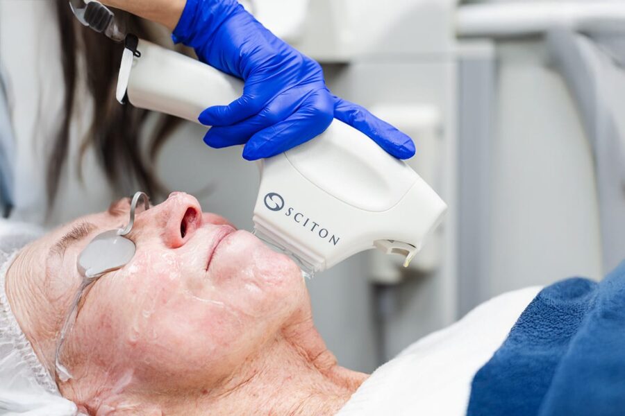 BroadBand Light (BBL) in Centerville, OH | Spa Medicca